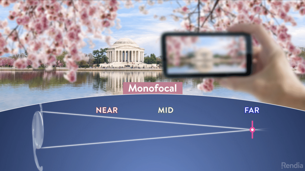 Your Lens Options - North Toronto Eye Surgery Centre