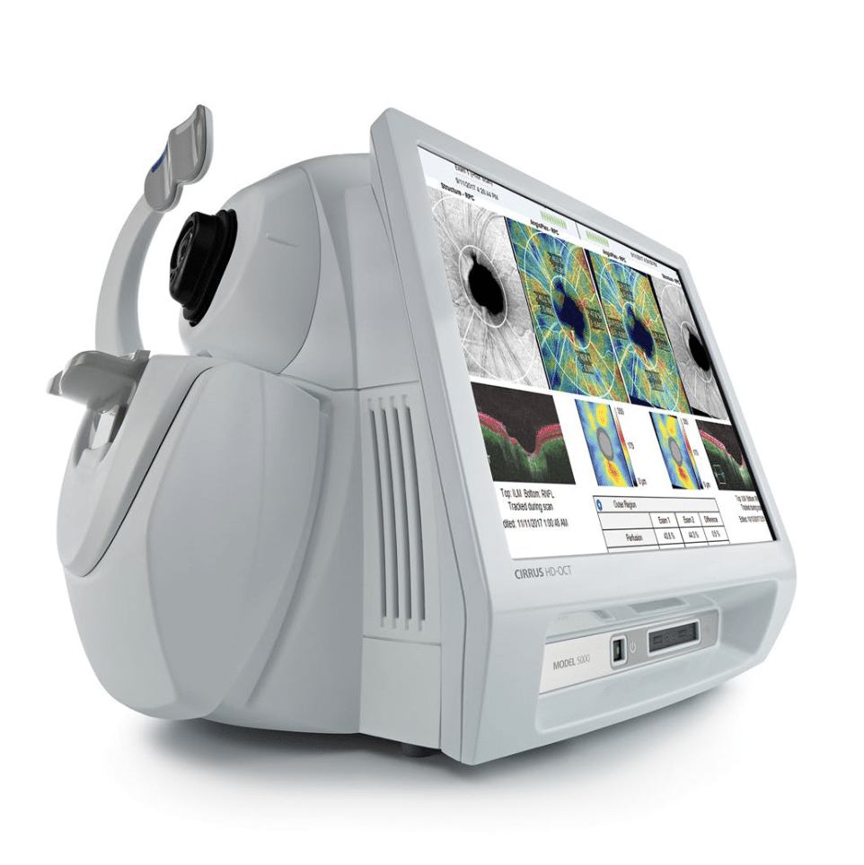 Advanced Glaucoma Technology | North Toronto Eye Care