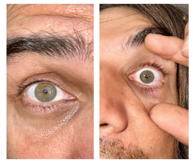 Eye Picture Instructions | North Toronto Eye Care